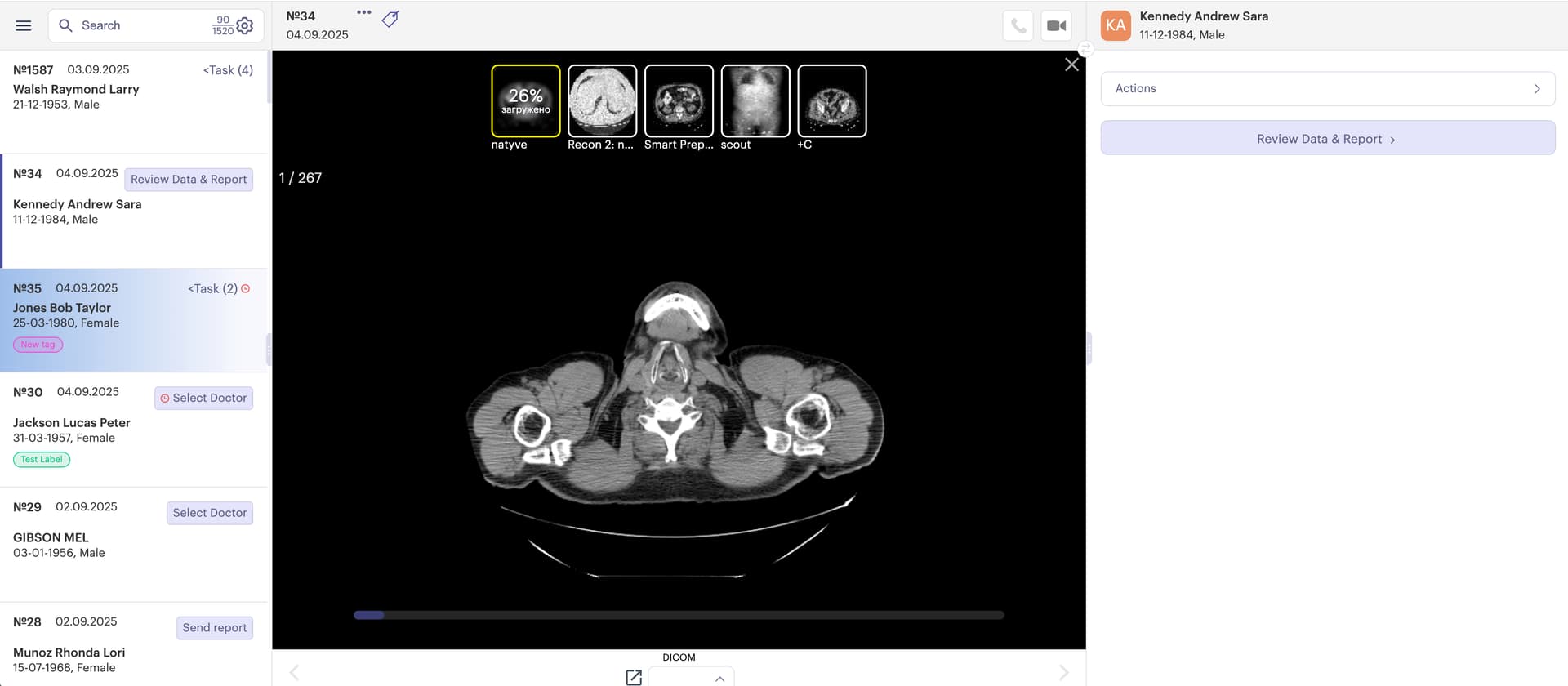 Custom Task List and Healthcare Platform Powered by Camunda - Show and ...